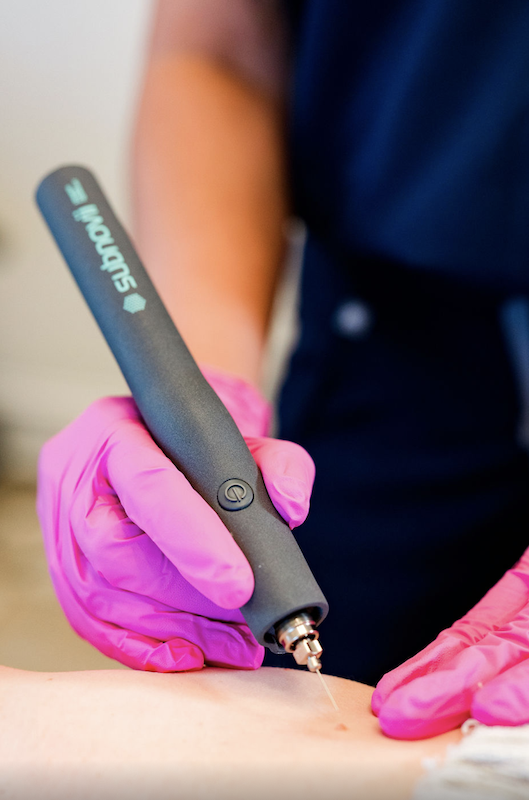 Plasma Pen in North Myrtle Beach | Touch MedSpa